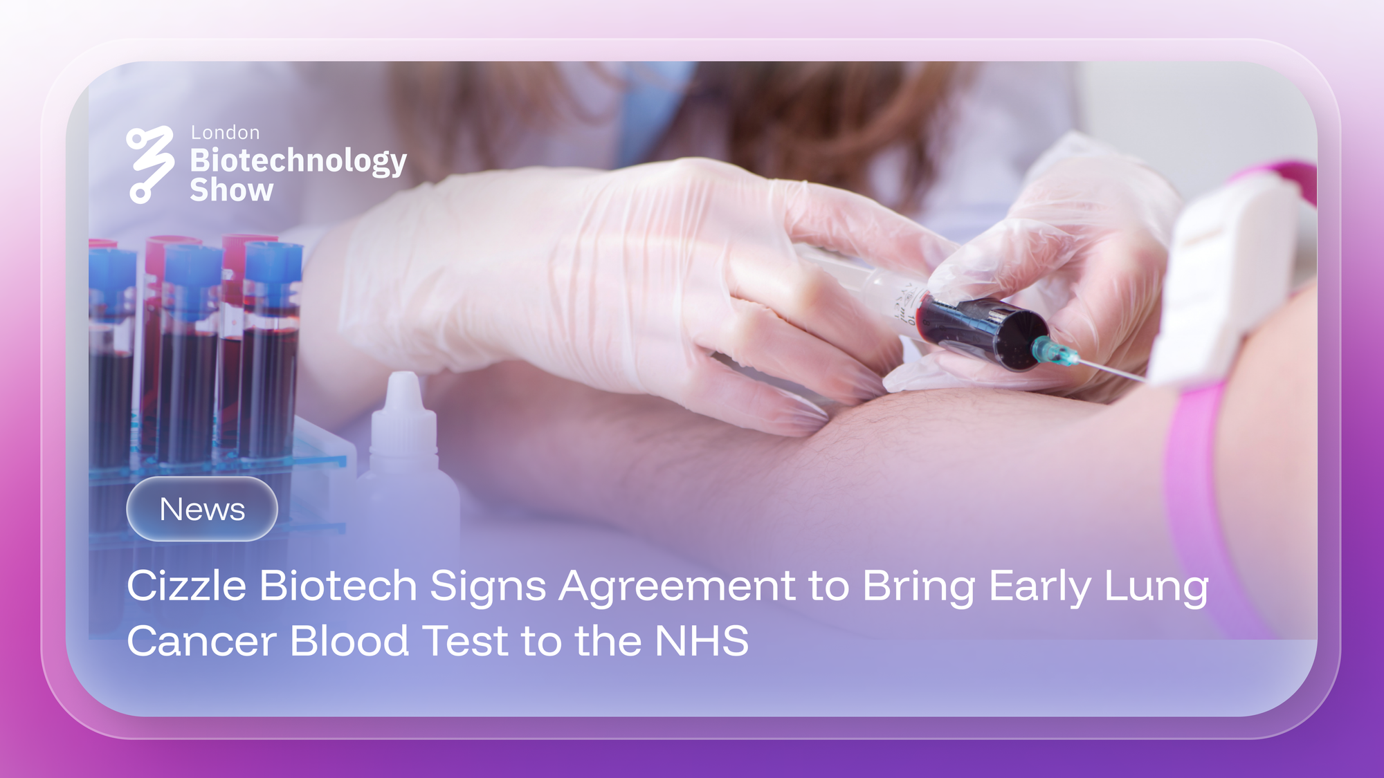 Cizzle Biotech to Bring Early Lung Cancer Blood Test to NHS